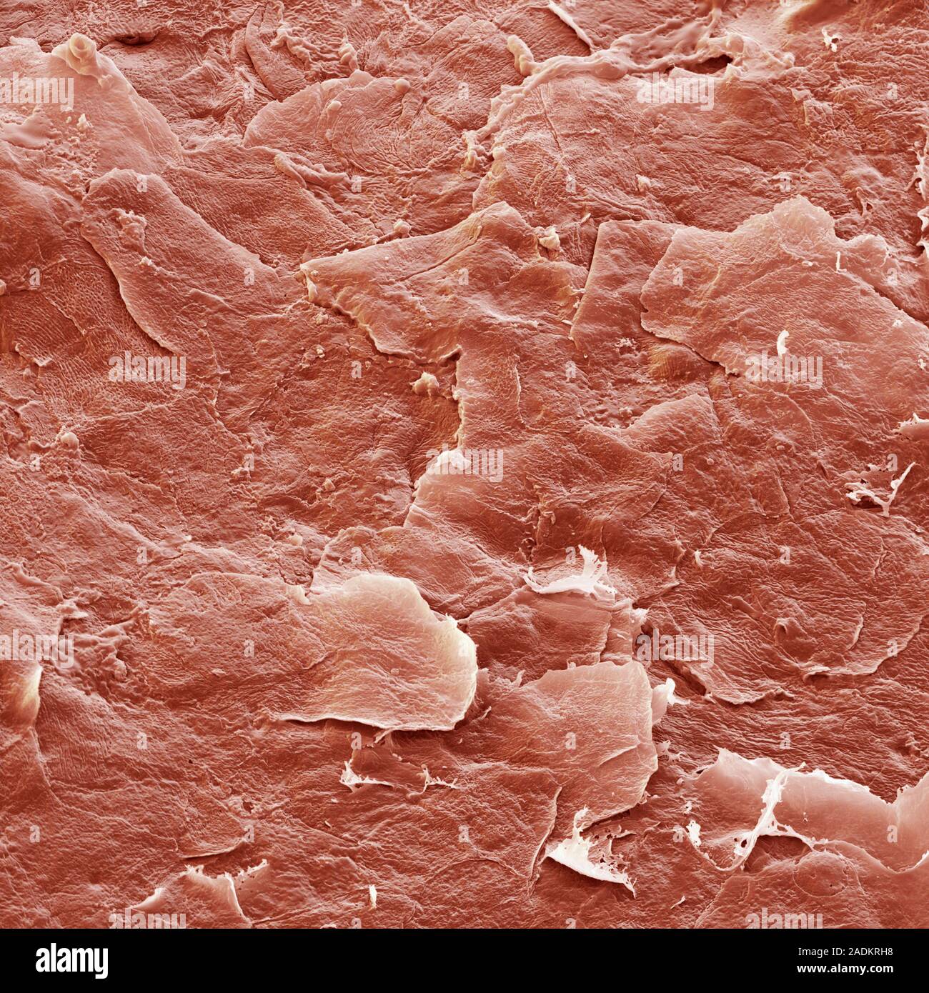 Dry skin. Coloured scanning electron micrograph (SEM) of dry skin from ...