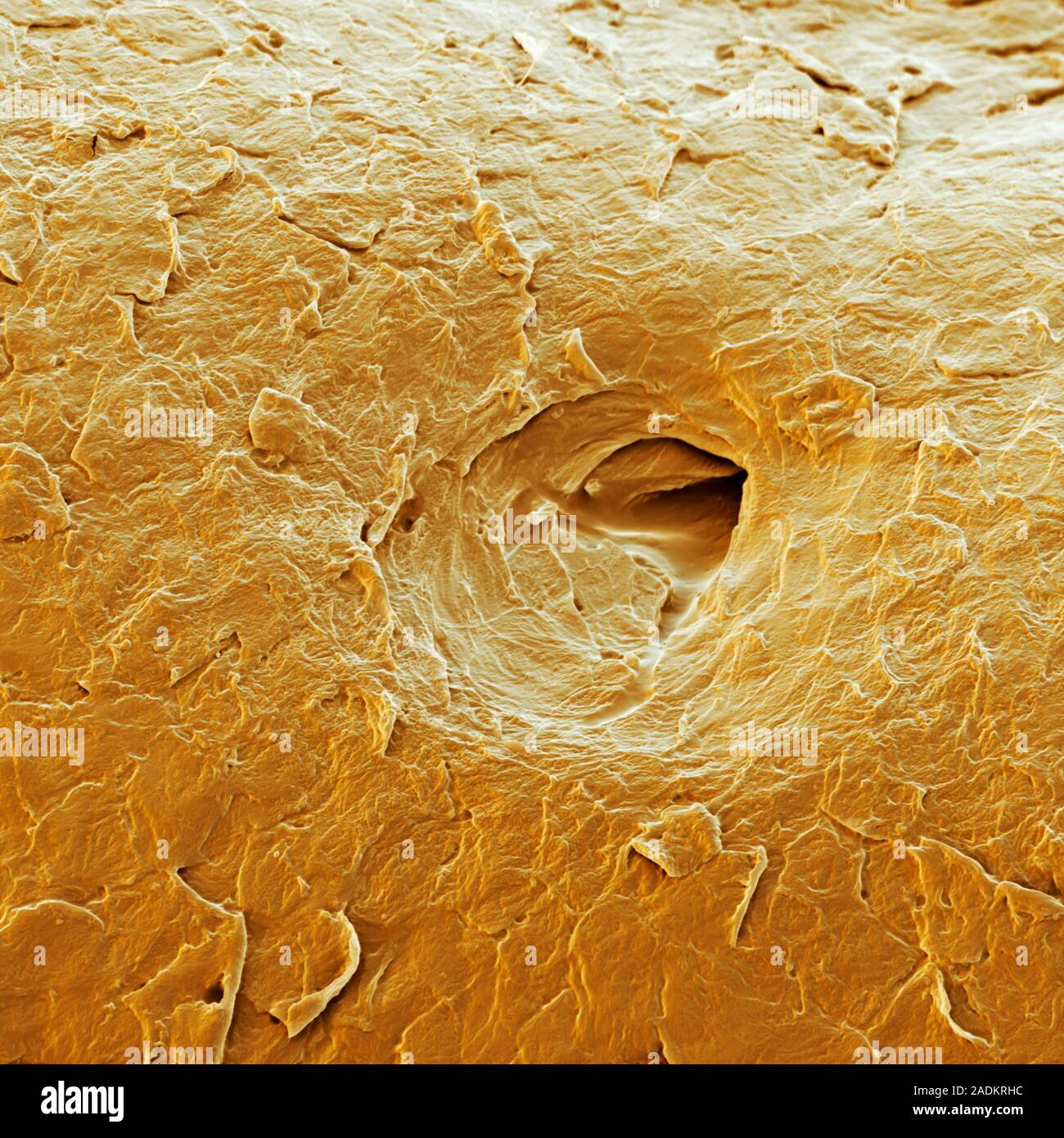 Sweat pore. Coloured scanning electron micrograph (SEM) of a sweat pore ...