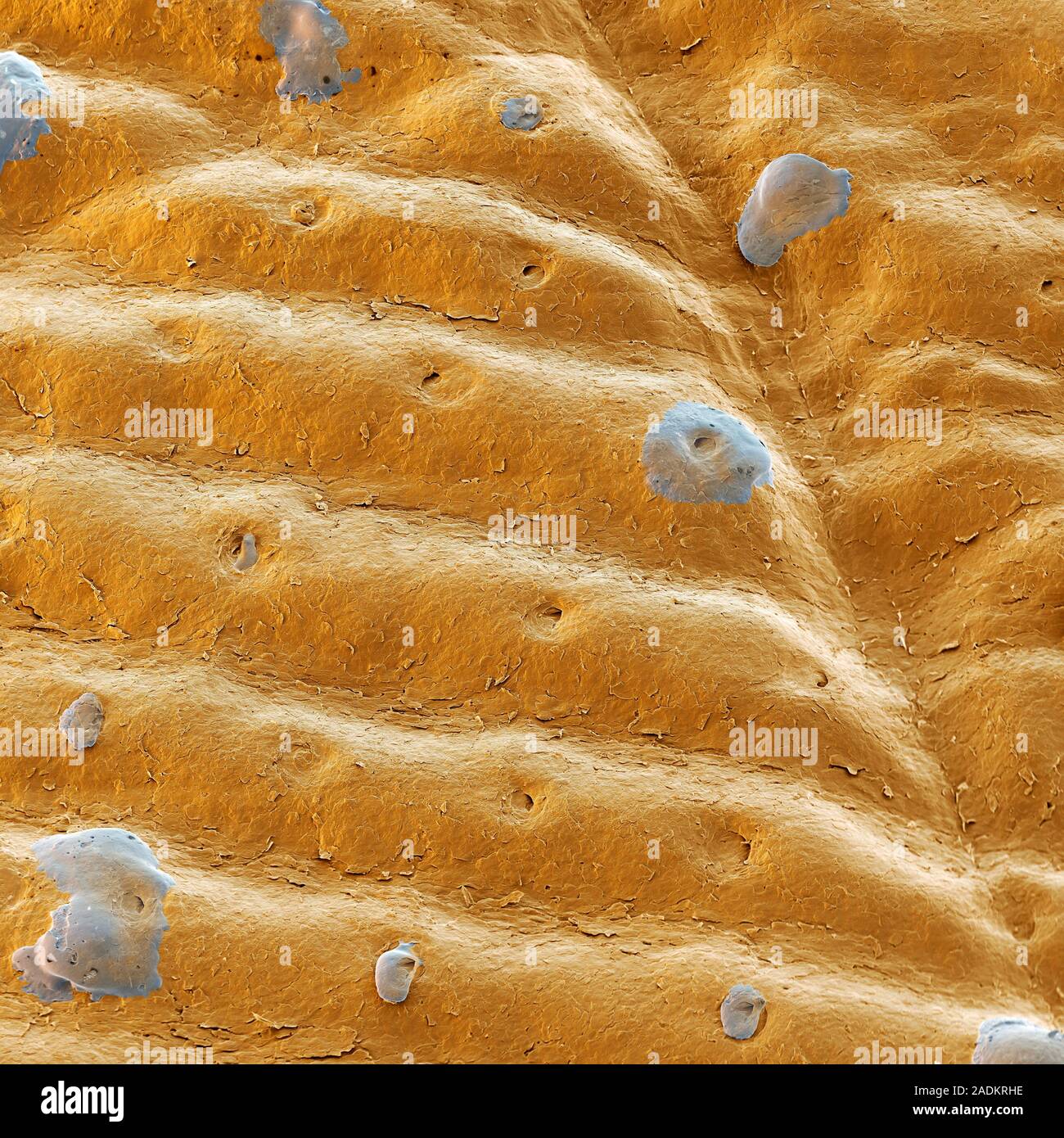 Sweat pores. Coloured scanning electron micrograph (SEM) of sweat ...