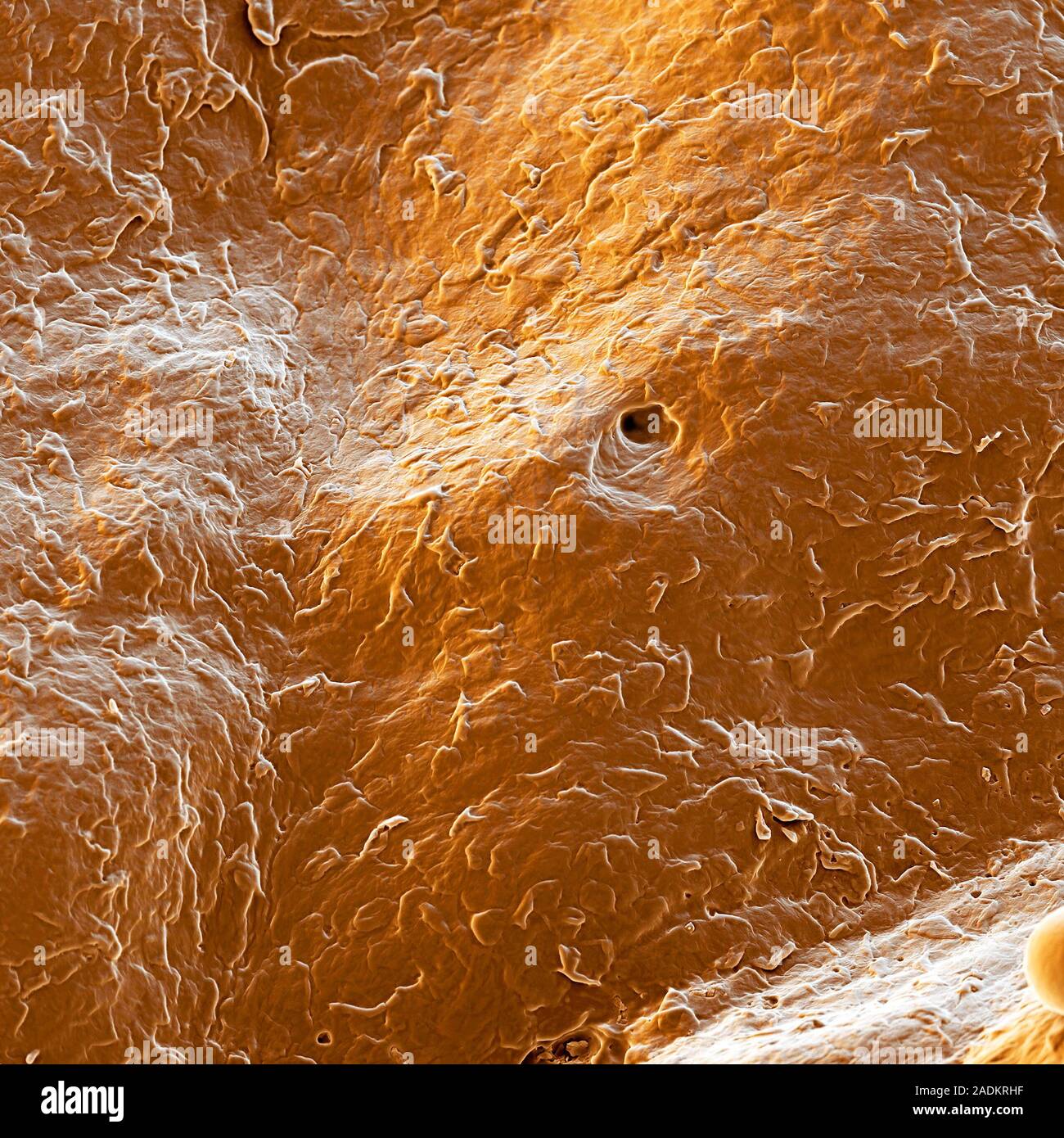 Sweat pore. Coloured scanning electron micrograph (SEM) of a sweat pore ...