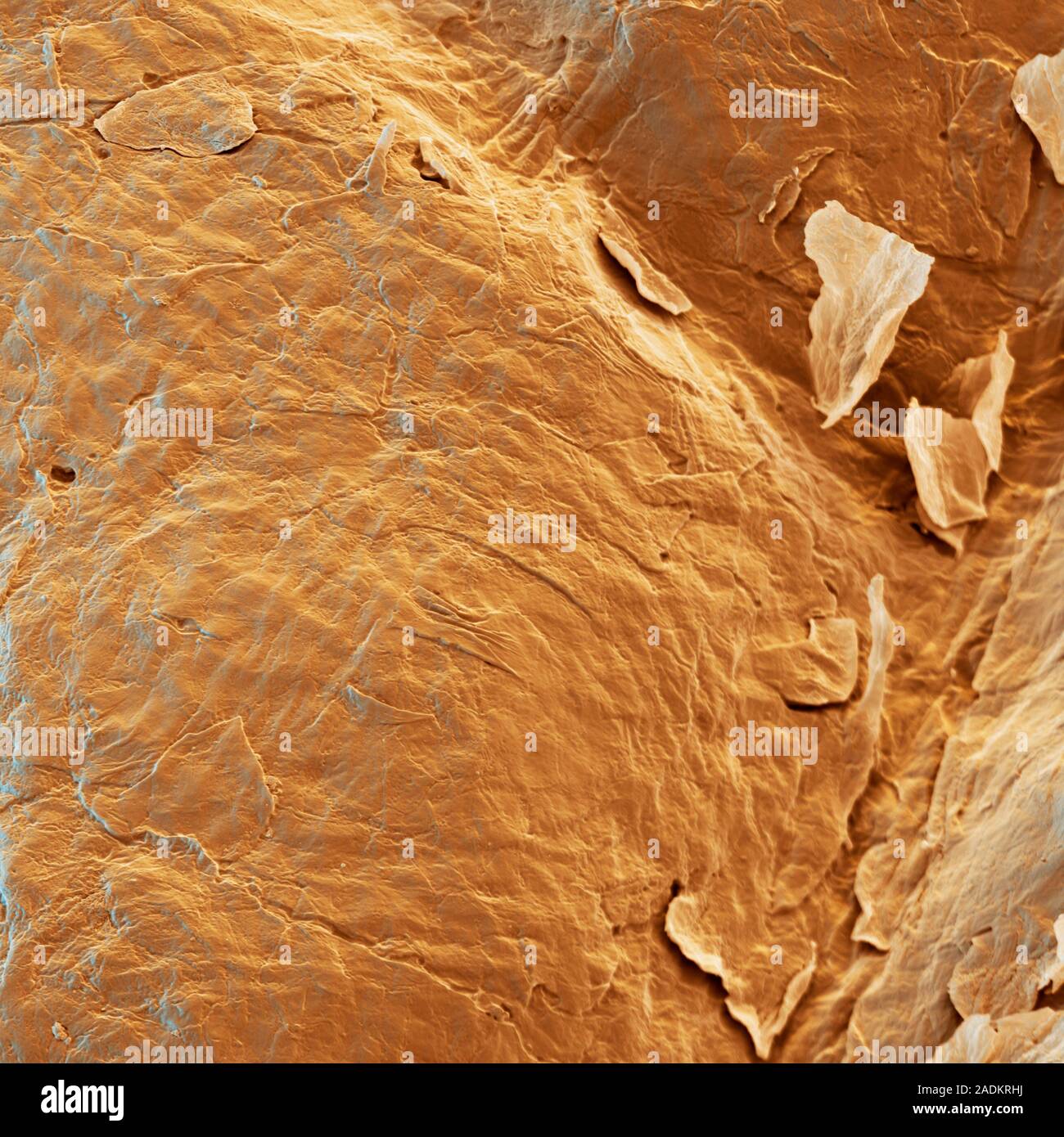 Skin surface. Coloured scanning electron micrograph (SEM) of dead cells ...