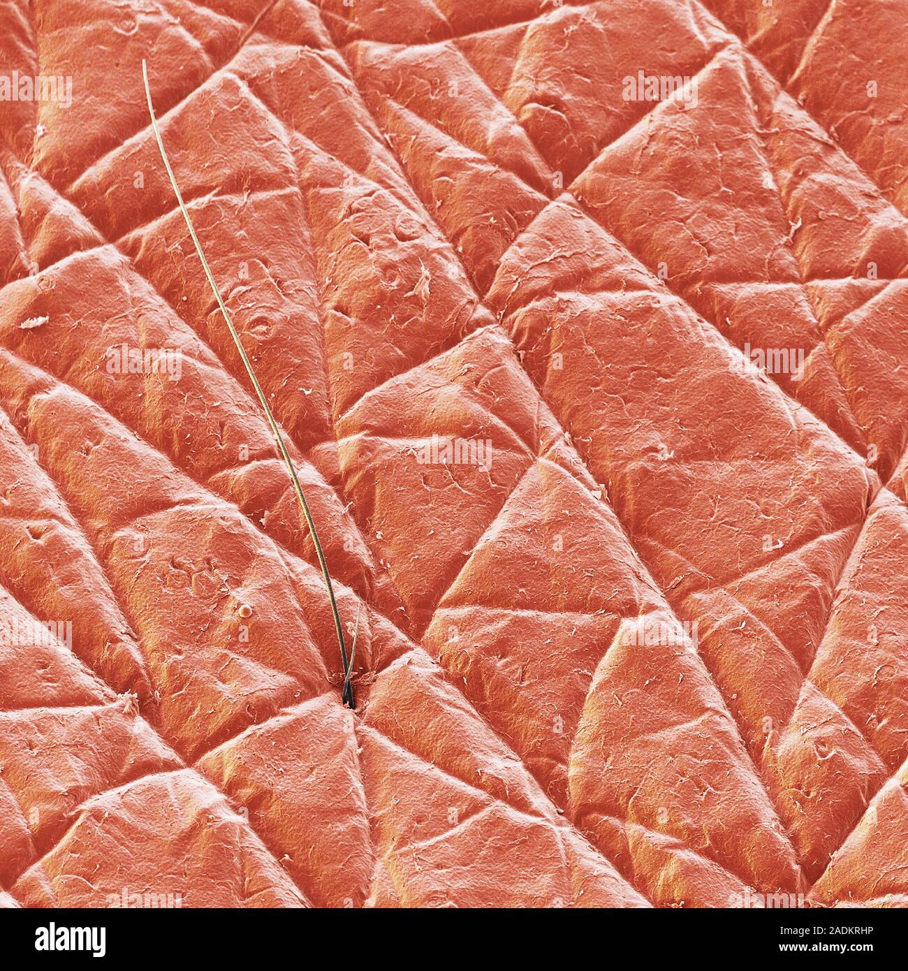 Skin surface. Coloured scanning electron micrograph (SEM) of the ...