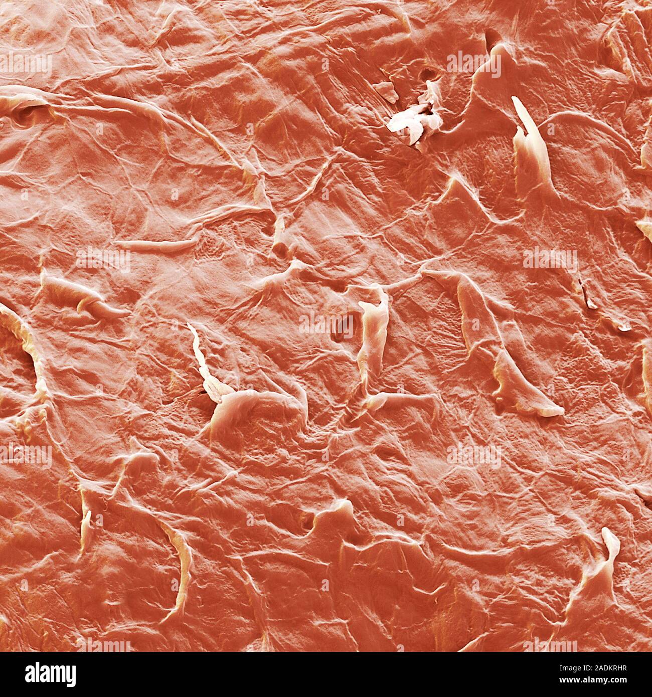 Skin surface. Coloured scanning electron micrograph (SEM) of skin taken ...