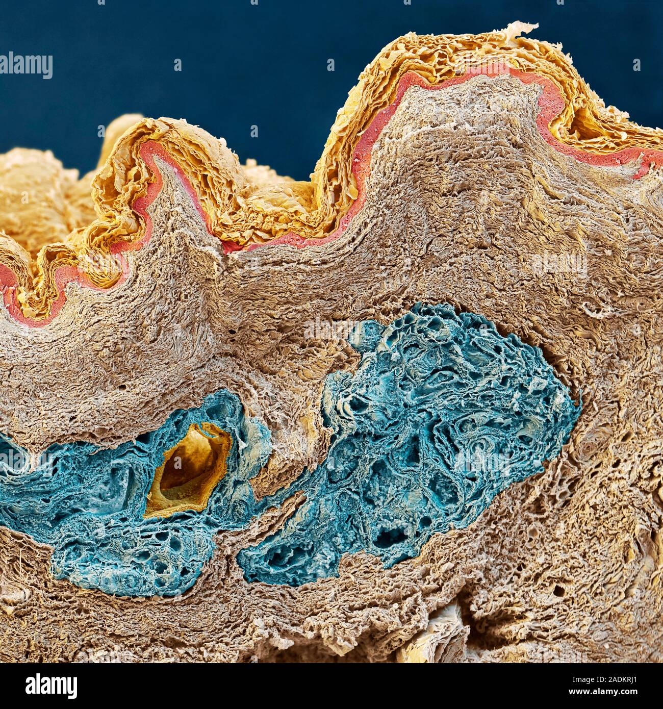Sebaceous gland. Coloured scanning electron micrograph (SEM) of ...