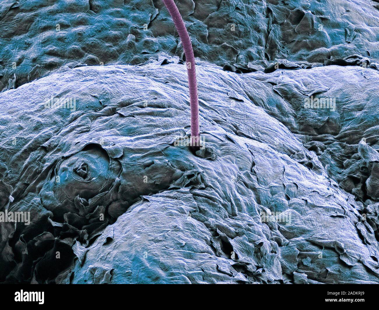 Skin. Coloured scanning electron micrograph (SEM) of skin and a hair ...