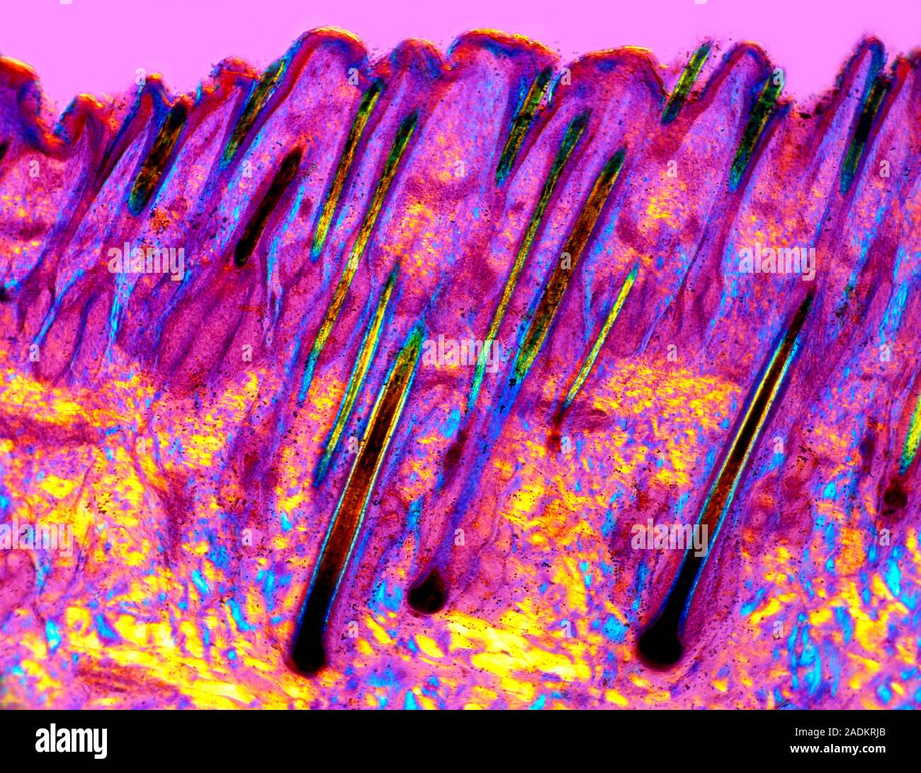 Human skin. Polarised light micrograph of a section through human skin ...