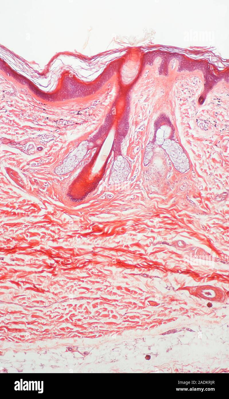 Human skin. Light micrograph of a section through healthy human skin ...