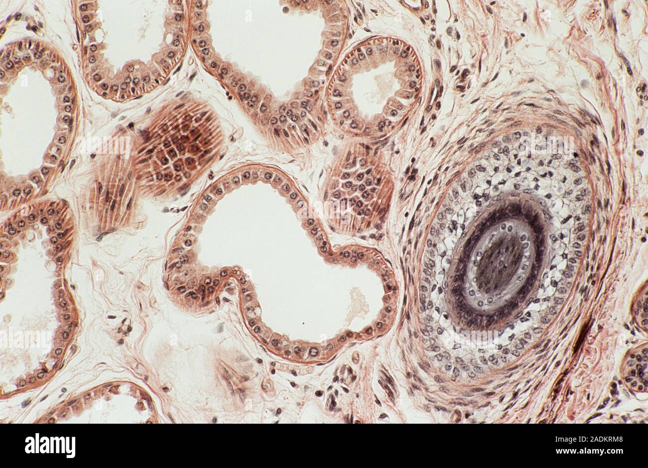 Underarm sweat glands. Light micrograph of a section through axillary ...