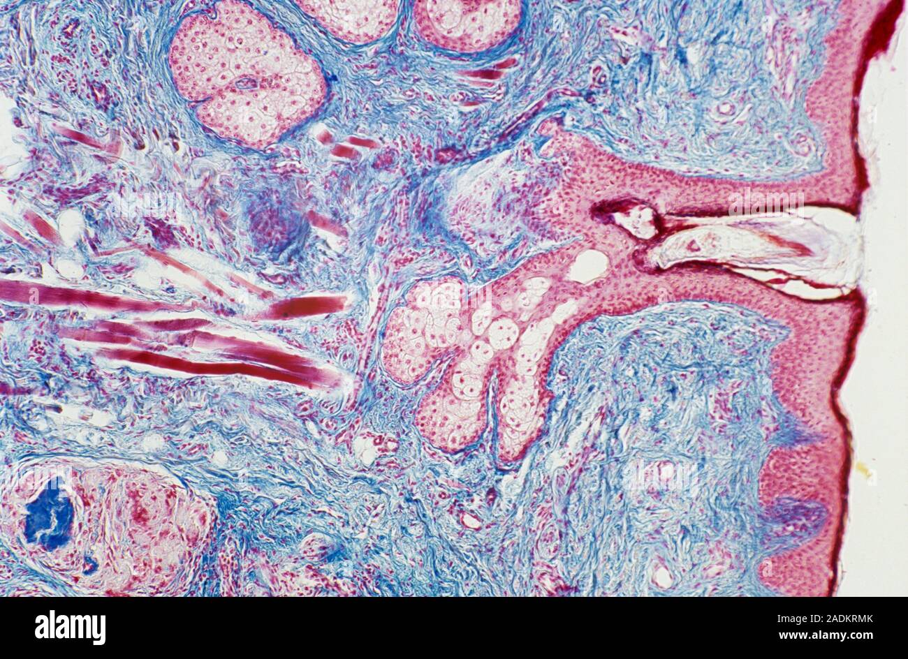 Human skin section. Light micrograph of a section through skin from the ...