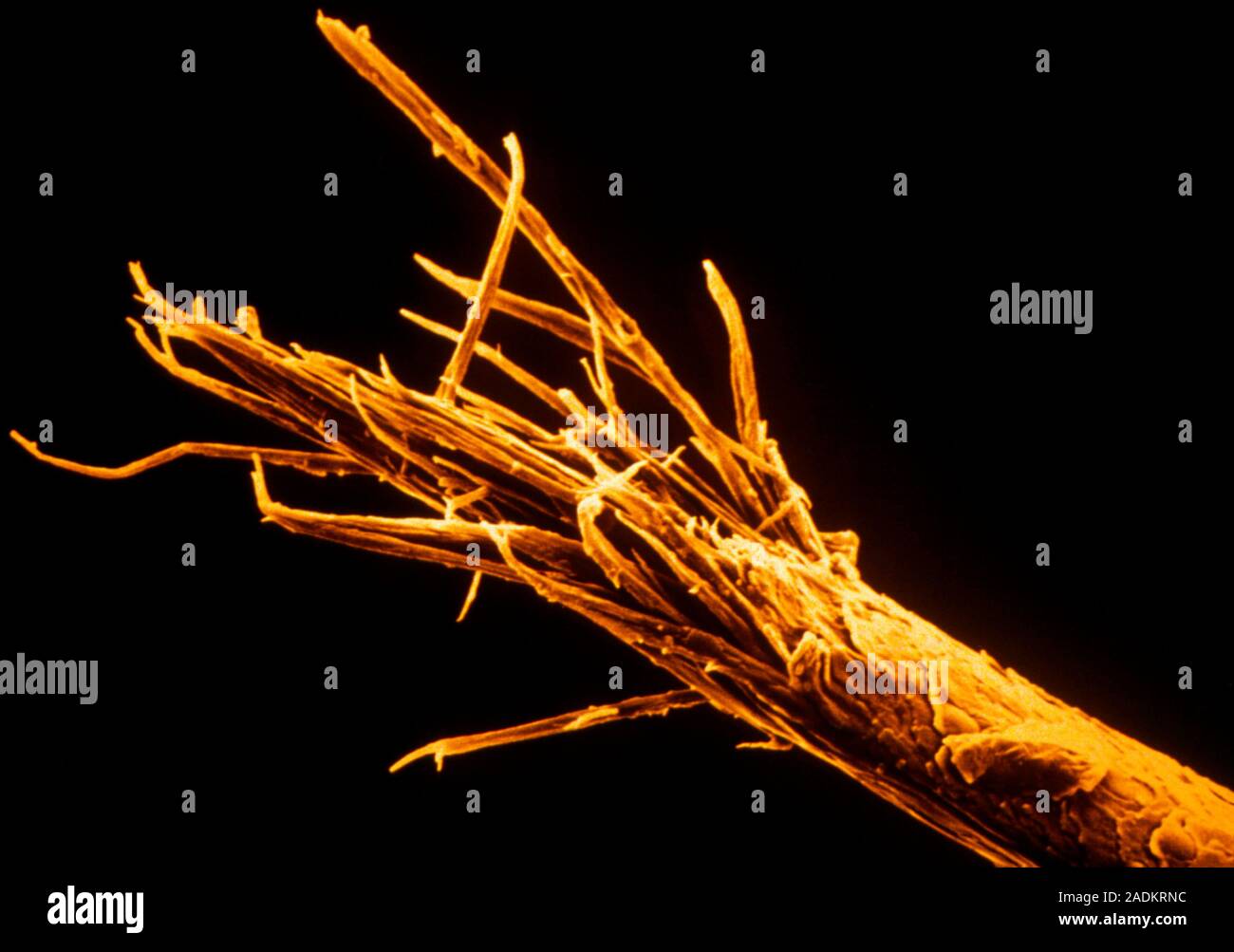 False-colour scanning electron micrograph (SEM) of a human hair with a ...