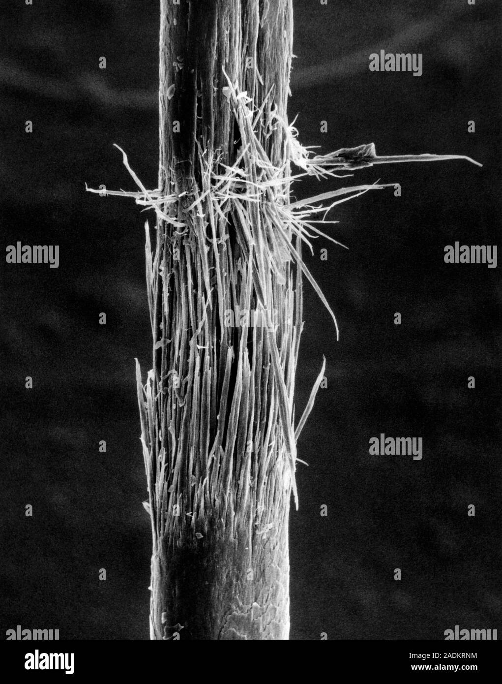 Scanning electron micrograph (SEM) of a shaft of badly damaged human ...