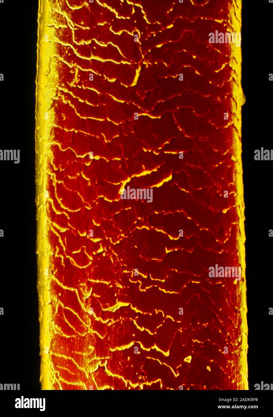 False-colour scanning electron micrograph (SEM) of a clean human hair ...