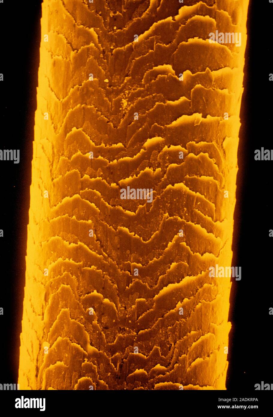 False-colour scanning electron micrograph (SEM) of a single shaft of ...