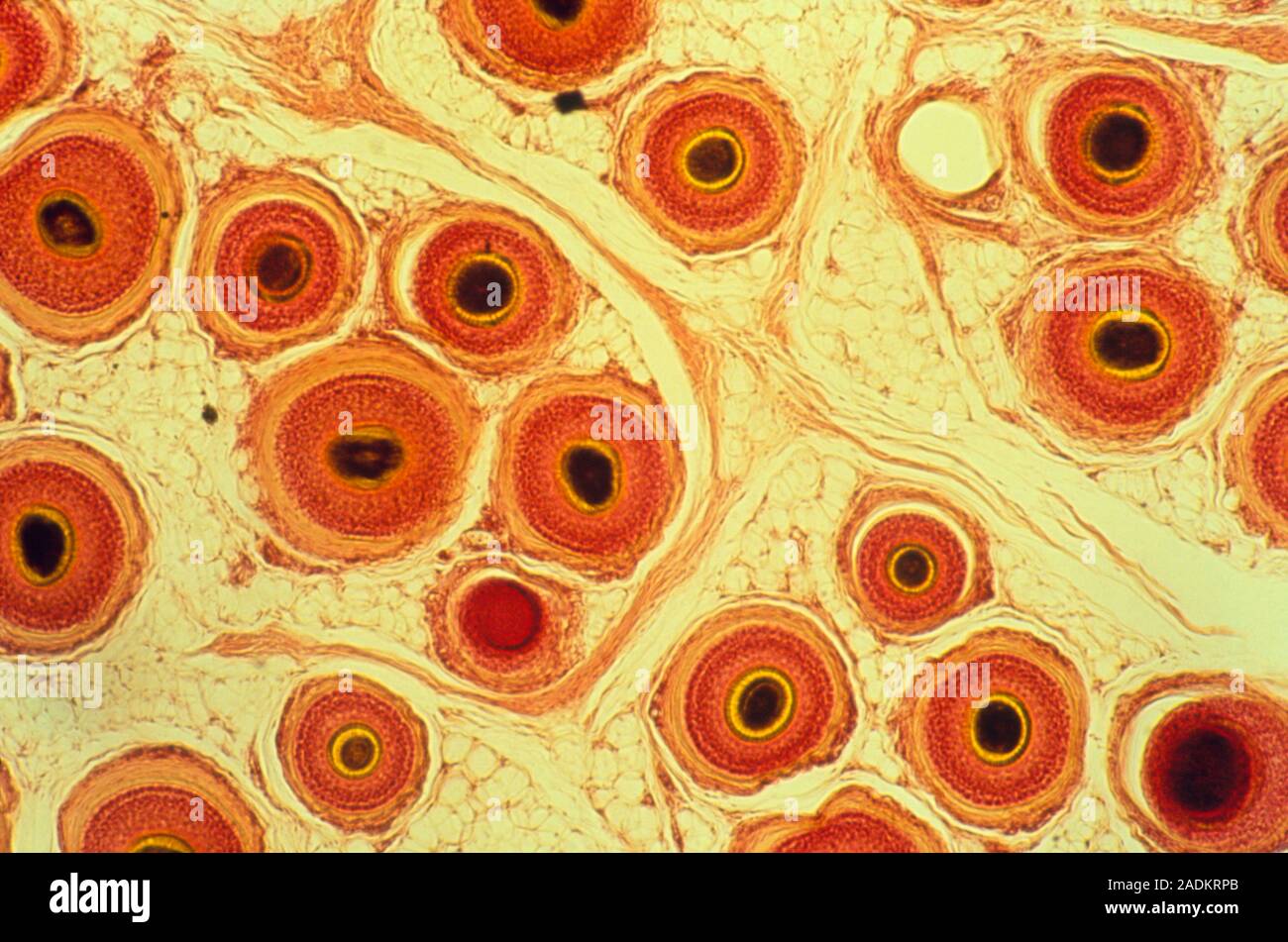 Light micrograph of a section through the human scalp showing some of ...