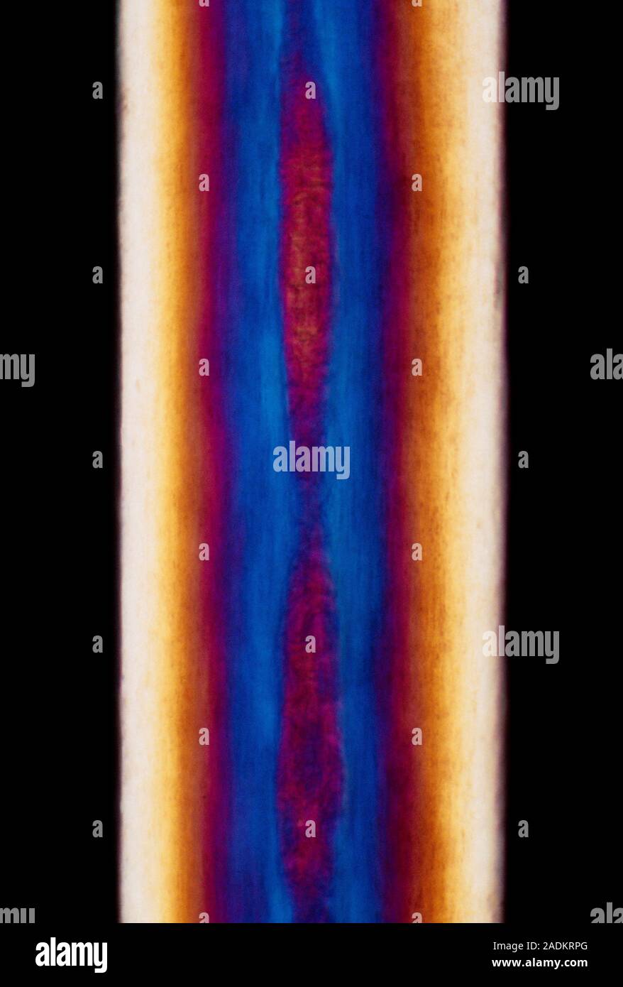 Light micrograph of a section through a human hair. The hair shaft ...