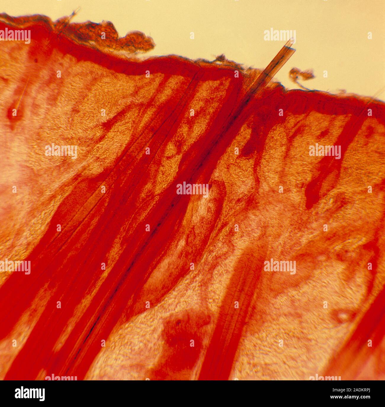 Light micrograph of a vertical section through the human scalp, showing ...