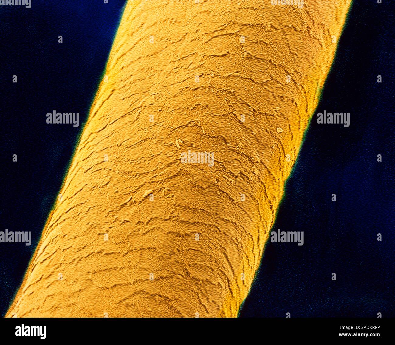 False-colour scanning electron micrograph of the shaft of a human hair ...