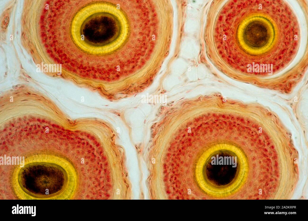 Light micrograph of a section through the human scalp showing hair ...