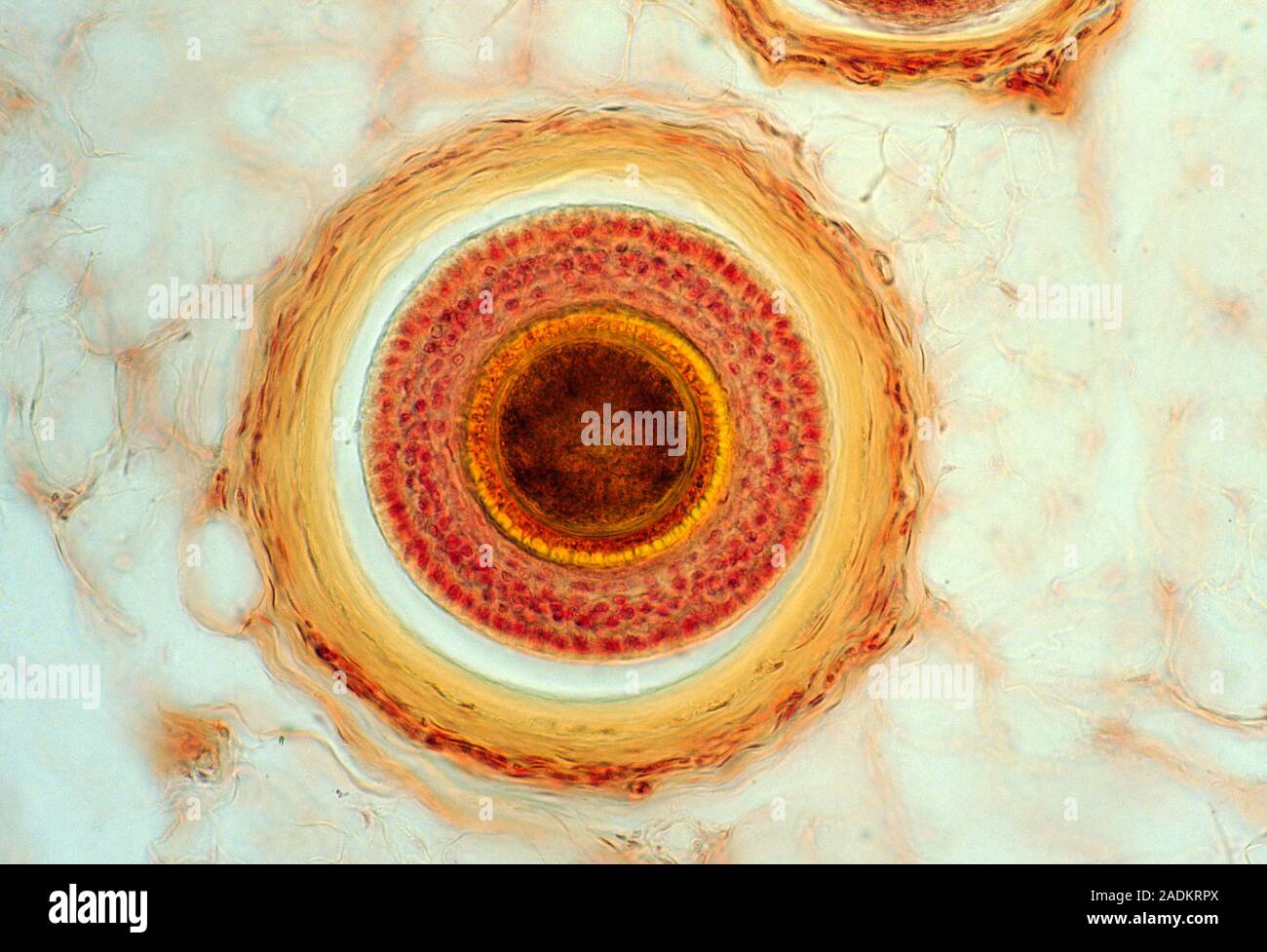 Light micrograph of a section through the human scalp showing a hair ...