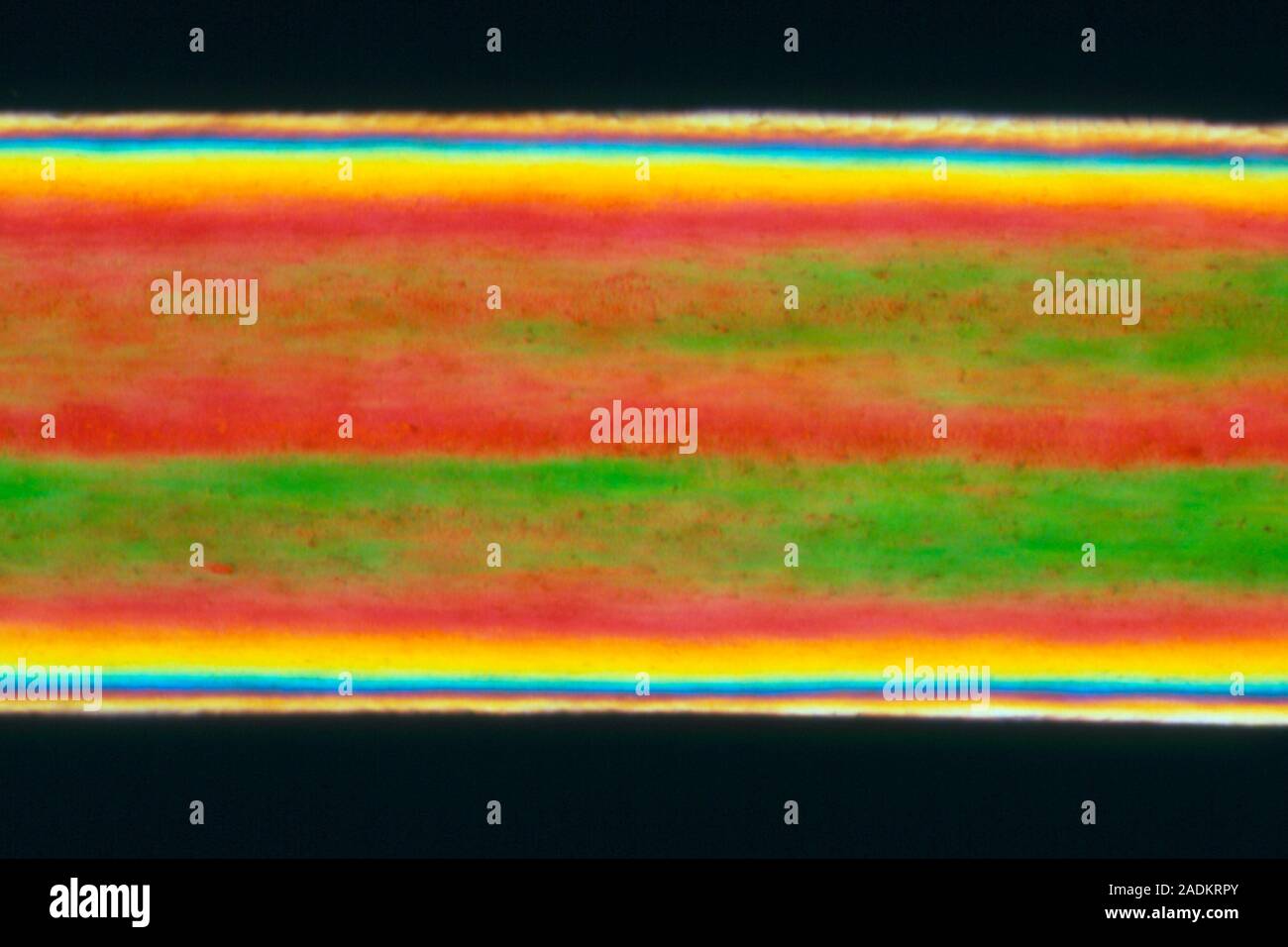 Polarised light micrograph of a human hair. This image shows the ...