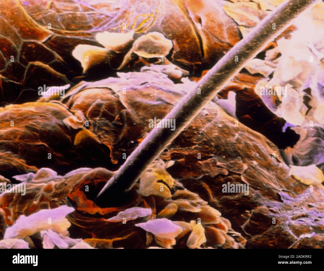 Hair. False-colour scanning electron micrograph of a hair protruding ...