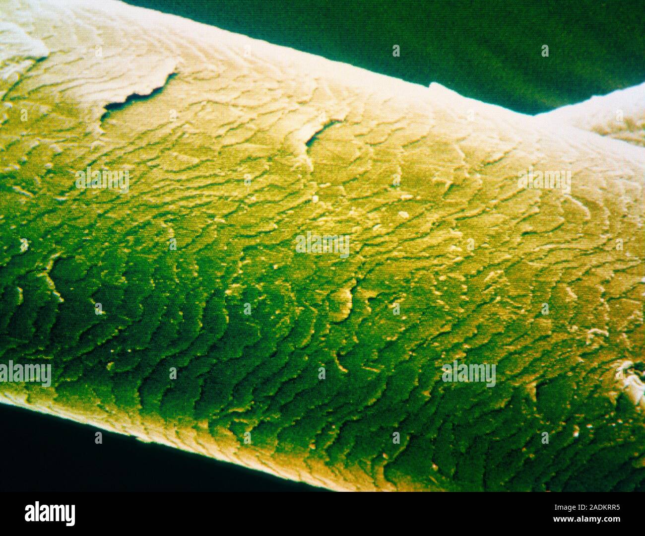 Surface of human hair. False-colour scanning electron micrograph (SEM ...