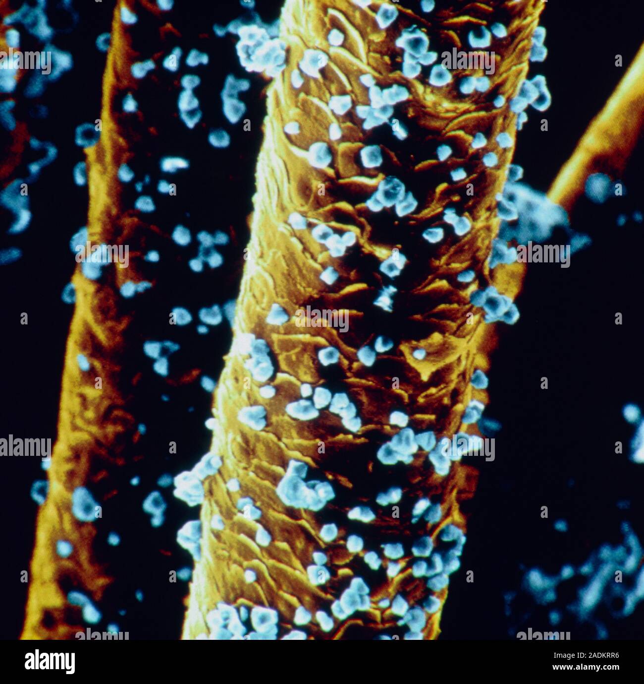 Hair. Coloured scanning electron micrograph (SEM) of hair partly ...