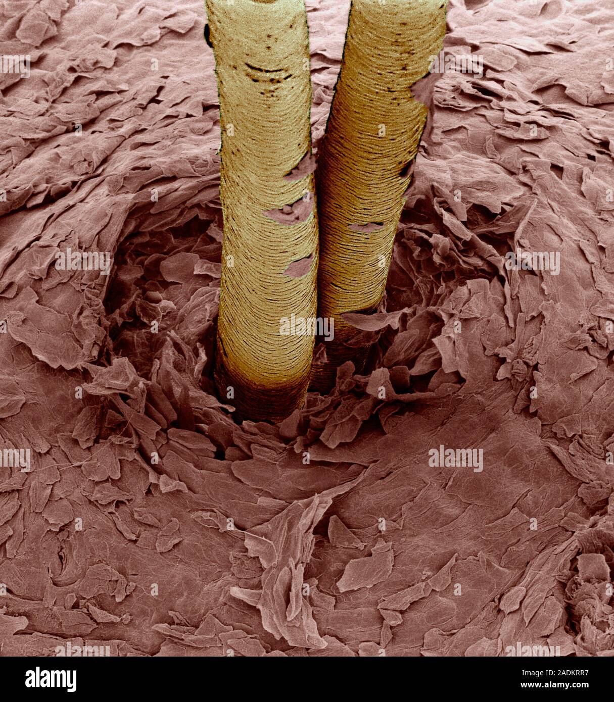 Hairs on scalp. Coloured Scanning Electron Micro- graph (SEM) of hairs ...