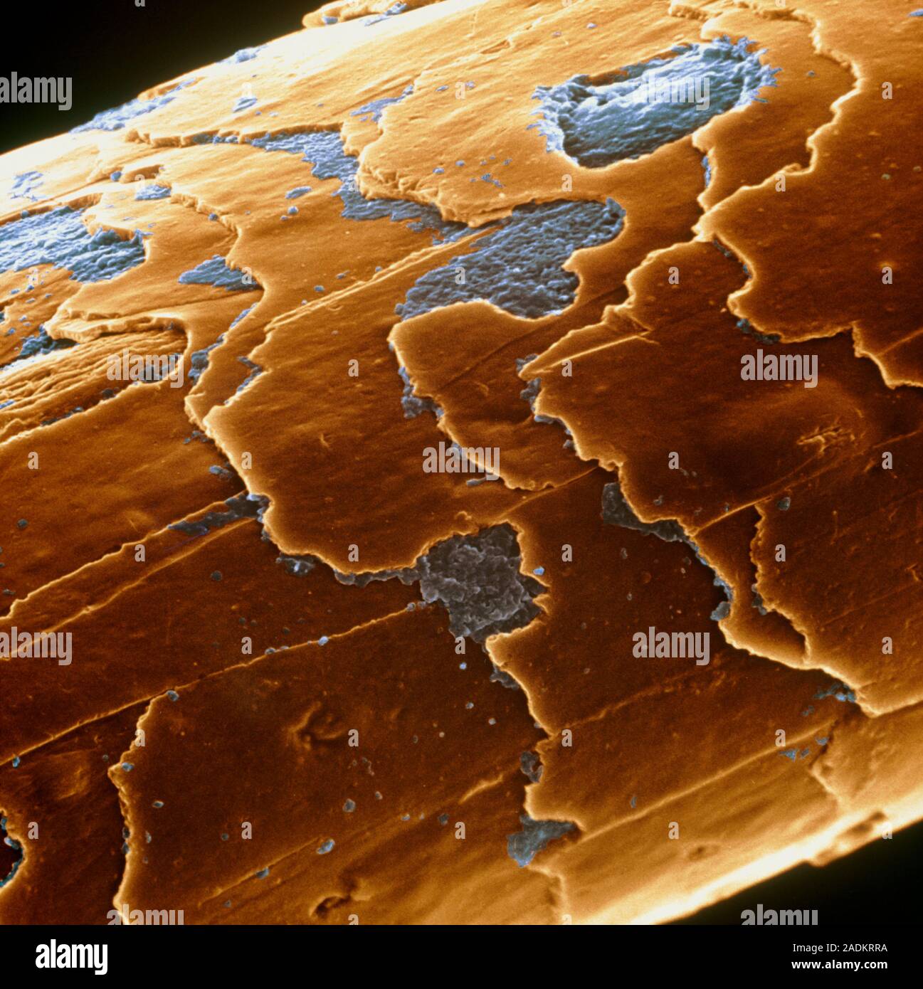 Human hair. Coloured Scanning Electron Micrograph (SEM) of a shaft of ...