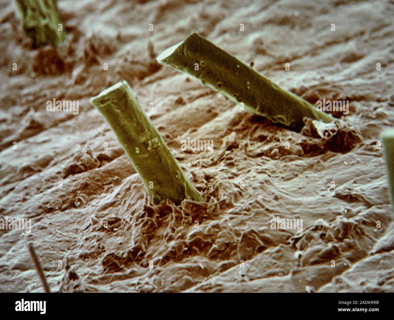 Shaved beard hair. Coloured Scanning Electron Micrograph (SEM) of beard ...