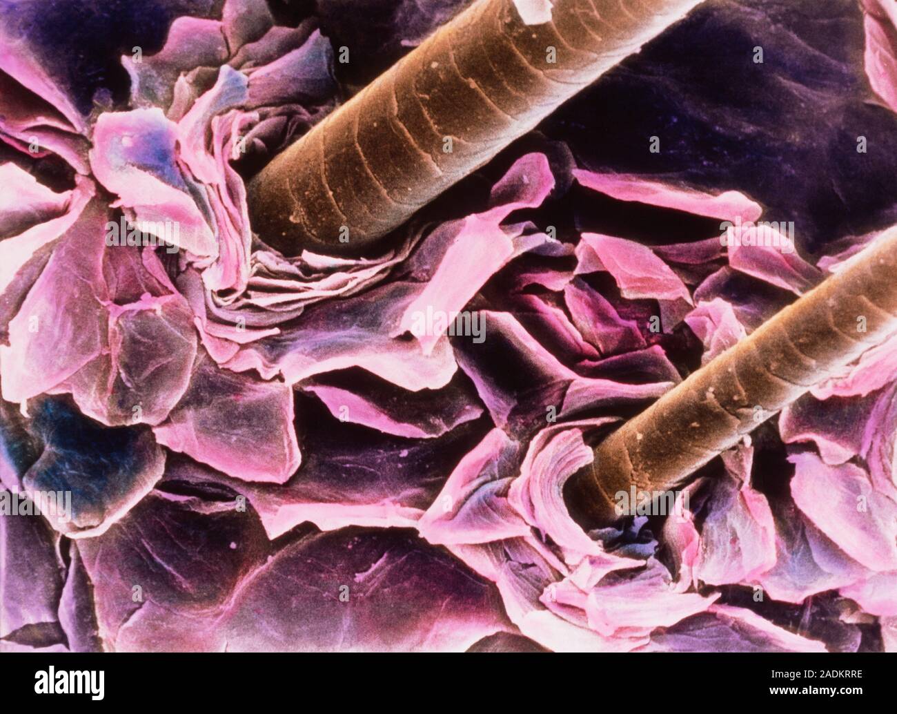 Hair. Coloured scanning electron micrograph of hairs protruding from ...