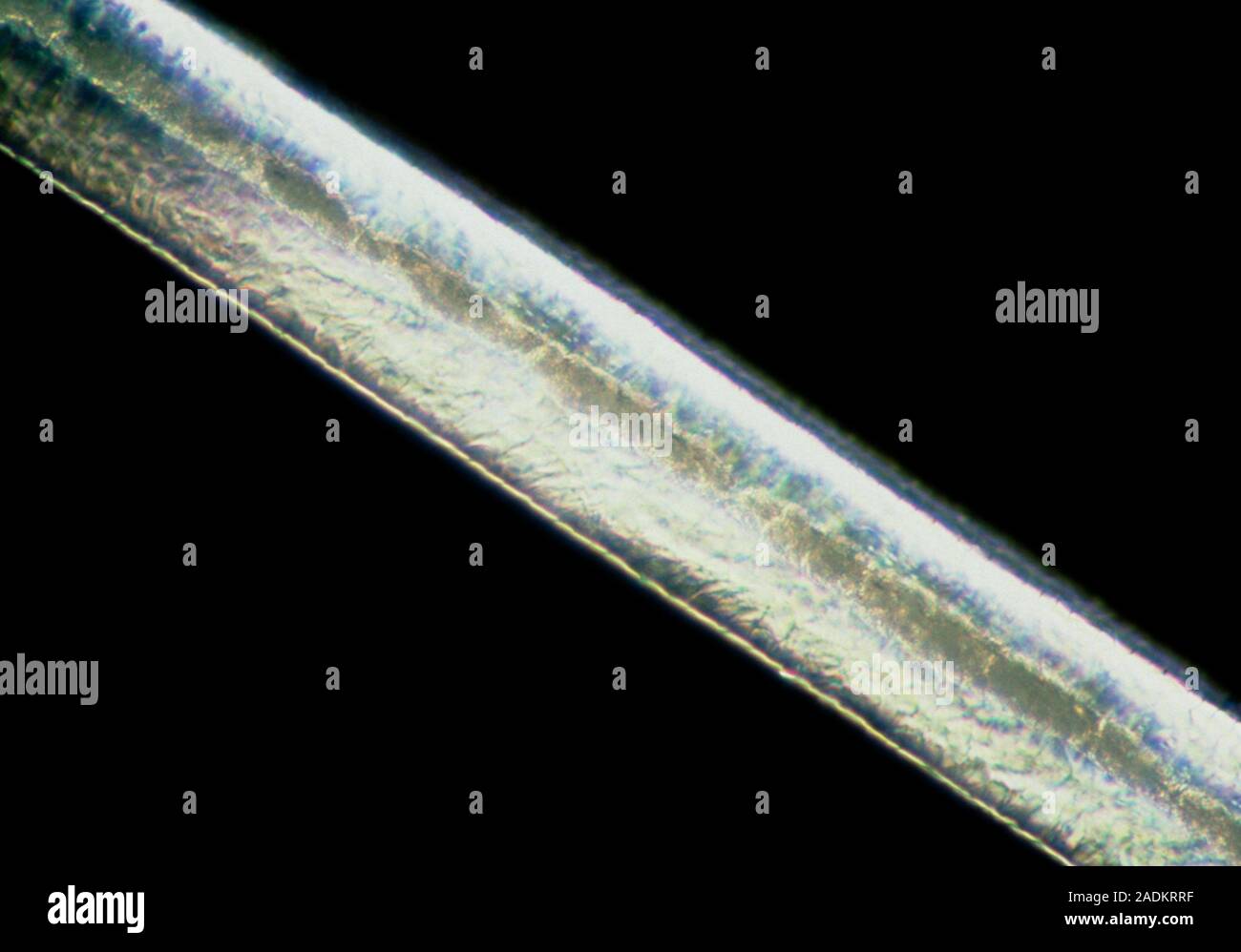 Grey hair. Light micrograph of a grey human hair. The surface scales of ...