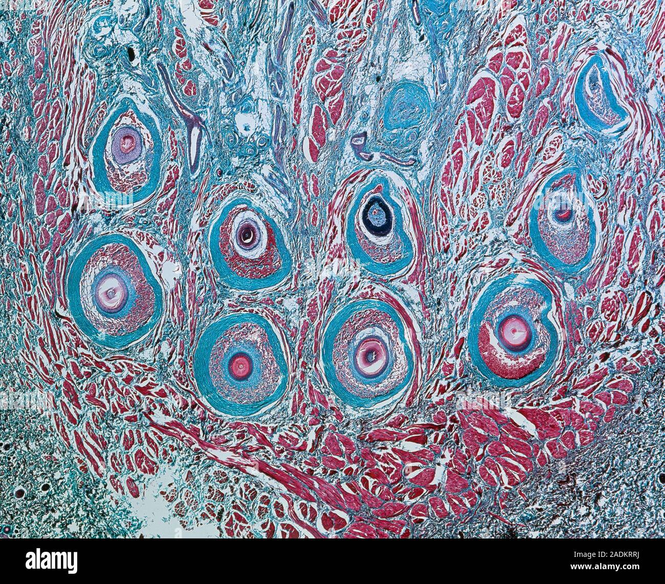 Skin with hair follicles. Light micrograph of a transverse section ...