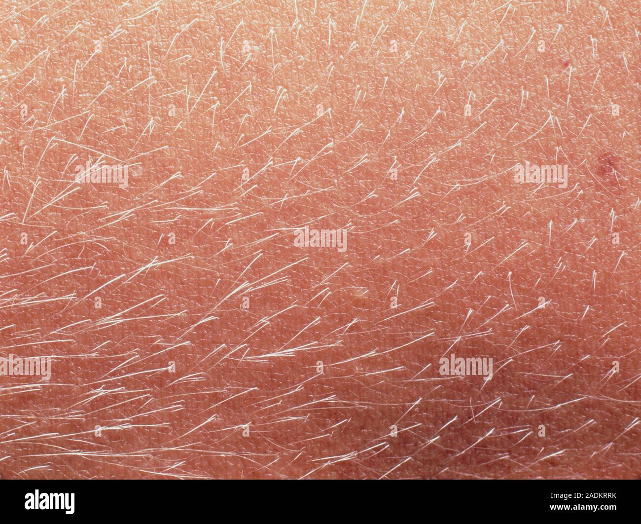 Human hair. Close-up of fine blonde hairs on the skin of a woman. Hairs ...