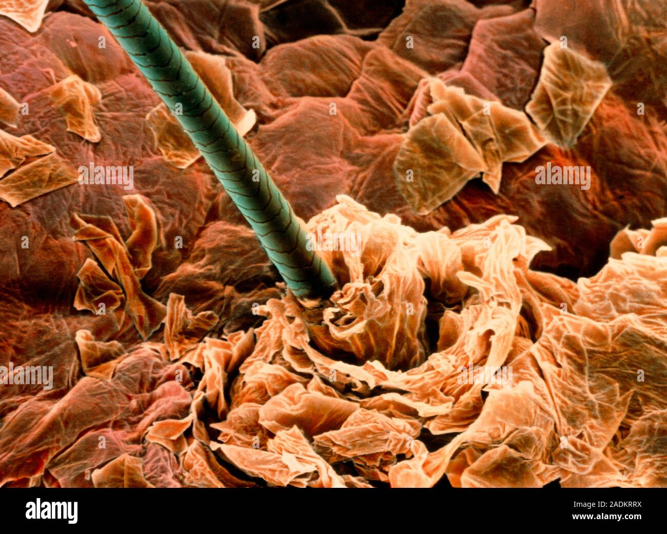 Hair on skin. Coloured Scanning Electron Micro- graph (SEM) of a hair ...