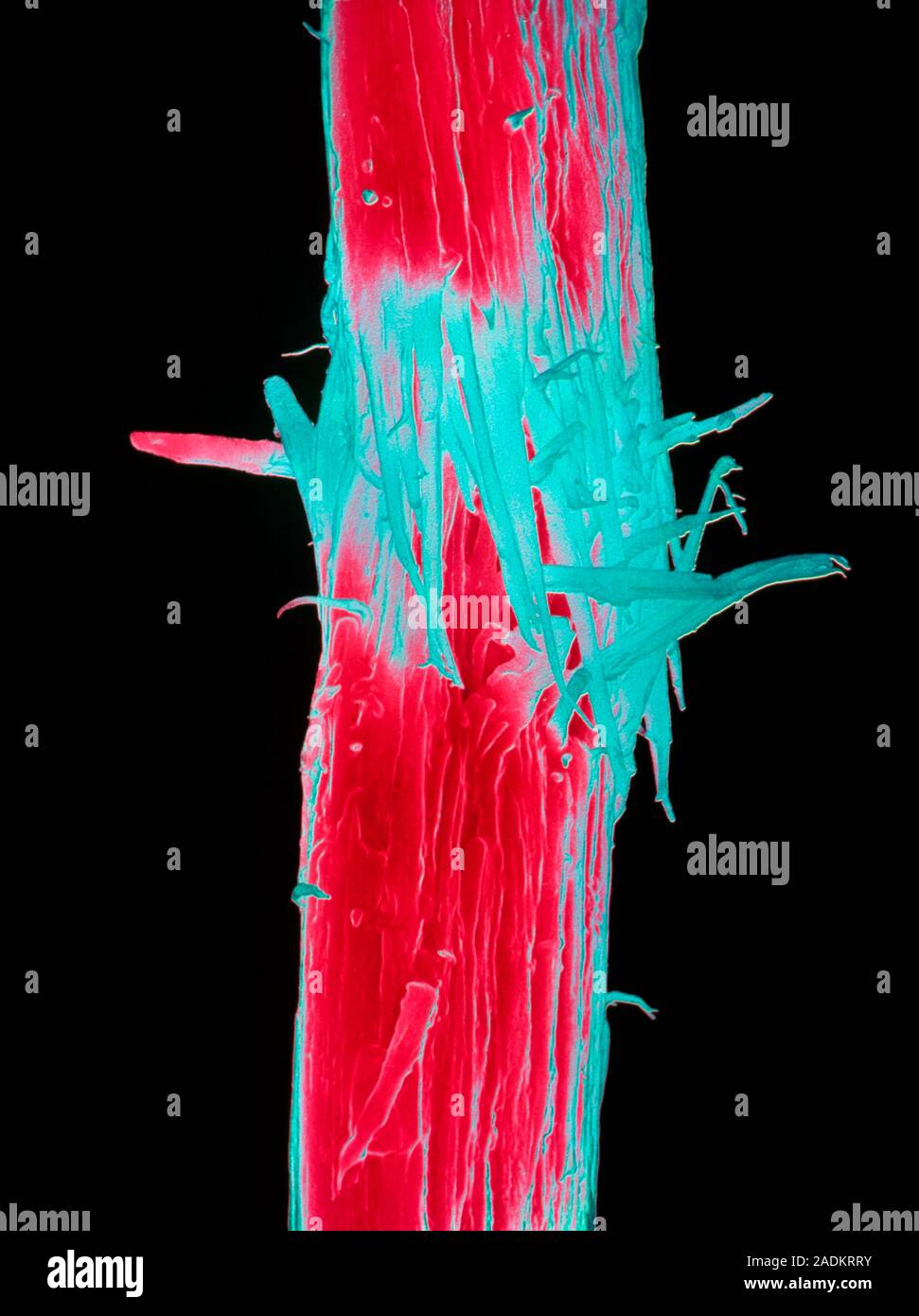Split hair. Coloured scanning electron micrograph (SEM) of a split ...