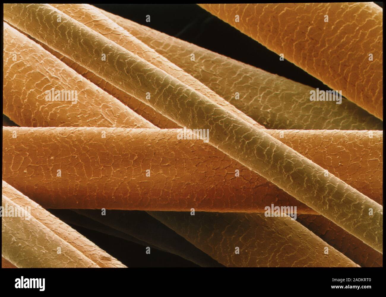 Human hair. Coloured Scanning Electron Micrograph (SEM) of numerous ...