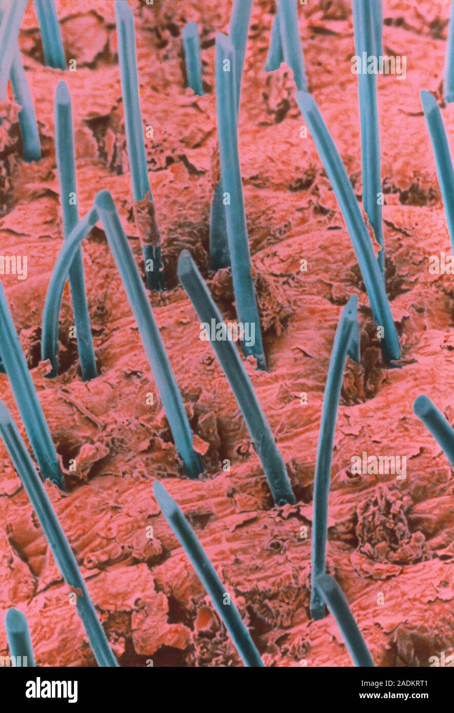 Shaved beard hair. Coloured scanning electron micrograph (SEM) of beard ...