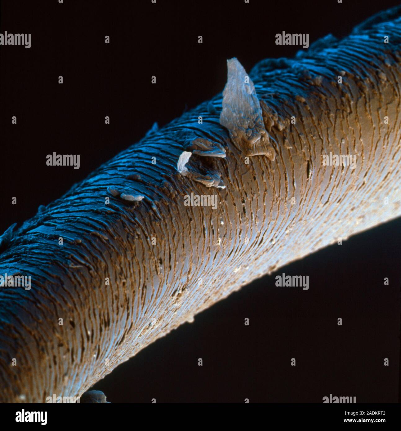 Human hair. Coloured Scanning Electron Micrograph (SEM) of a human hair ...