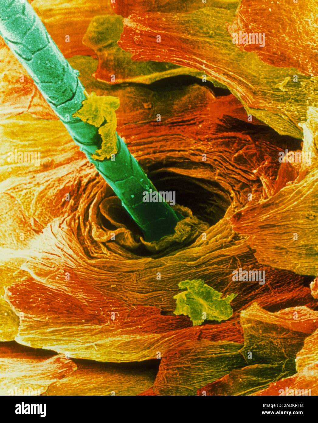 Hair shaft. Coloured scanning electron micrograph (SEM) of a hair ...