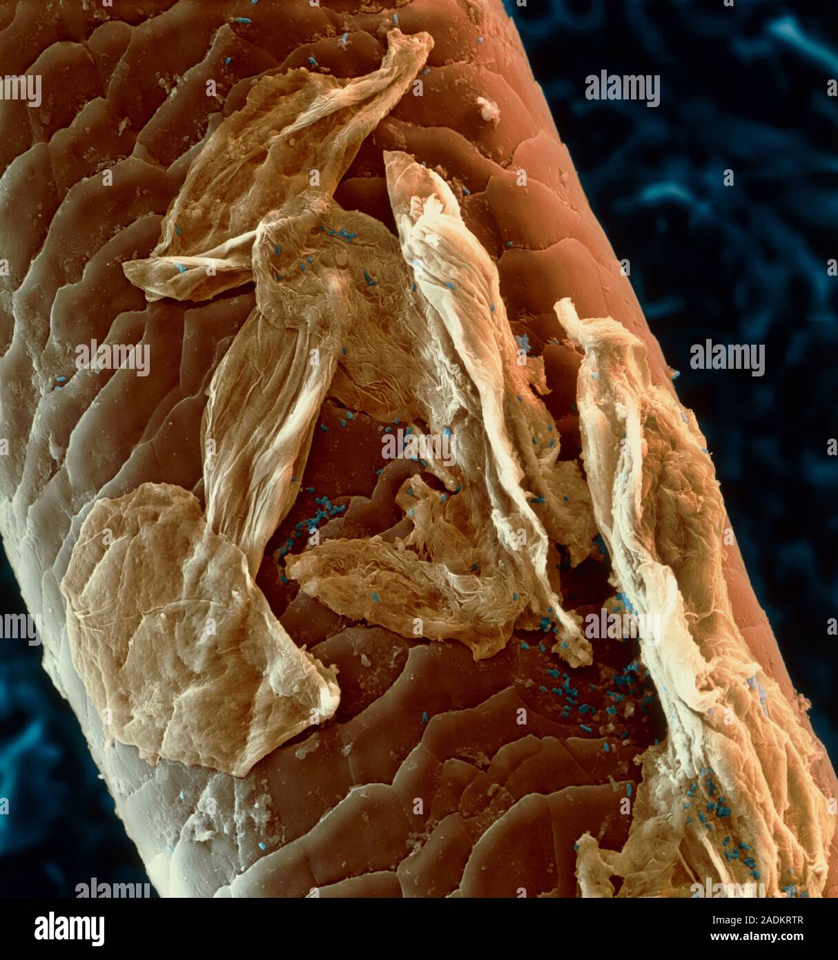 Underarm hair. Coloured scanning electron micrograph (SEM) of a human ...