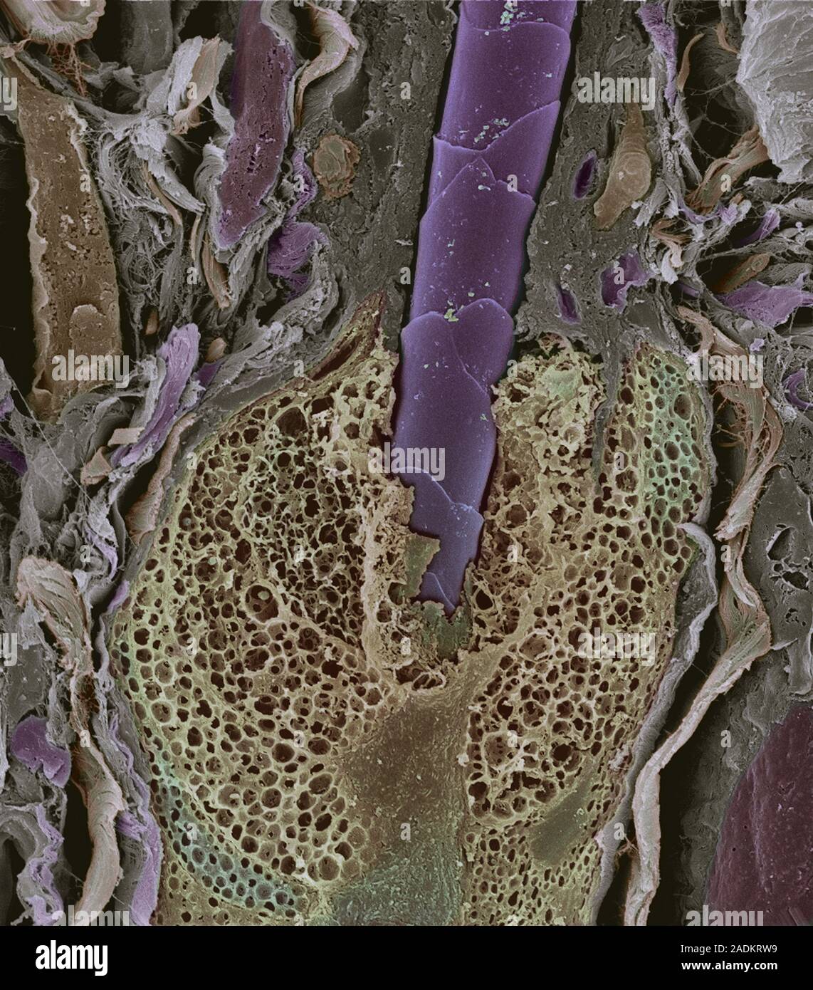 Hair follicle. Coloured scanning electron micrograph (SEM) of a longitudinal section through a ...