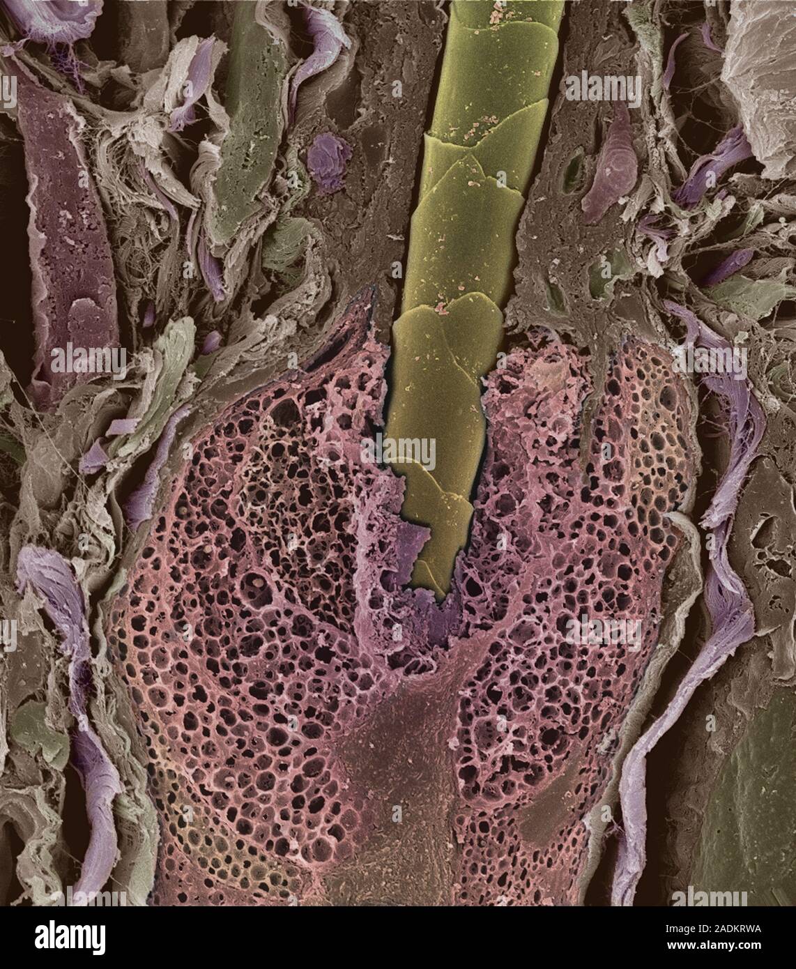 Hair follicle. Coloured scanning electron micrograph (SEM) of a ...