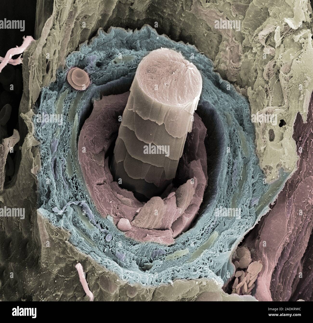 Hair follicle. Coloured scanning electron micrograph (SEM) of a transverse freeze-fractured ...