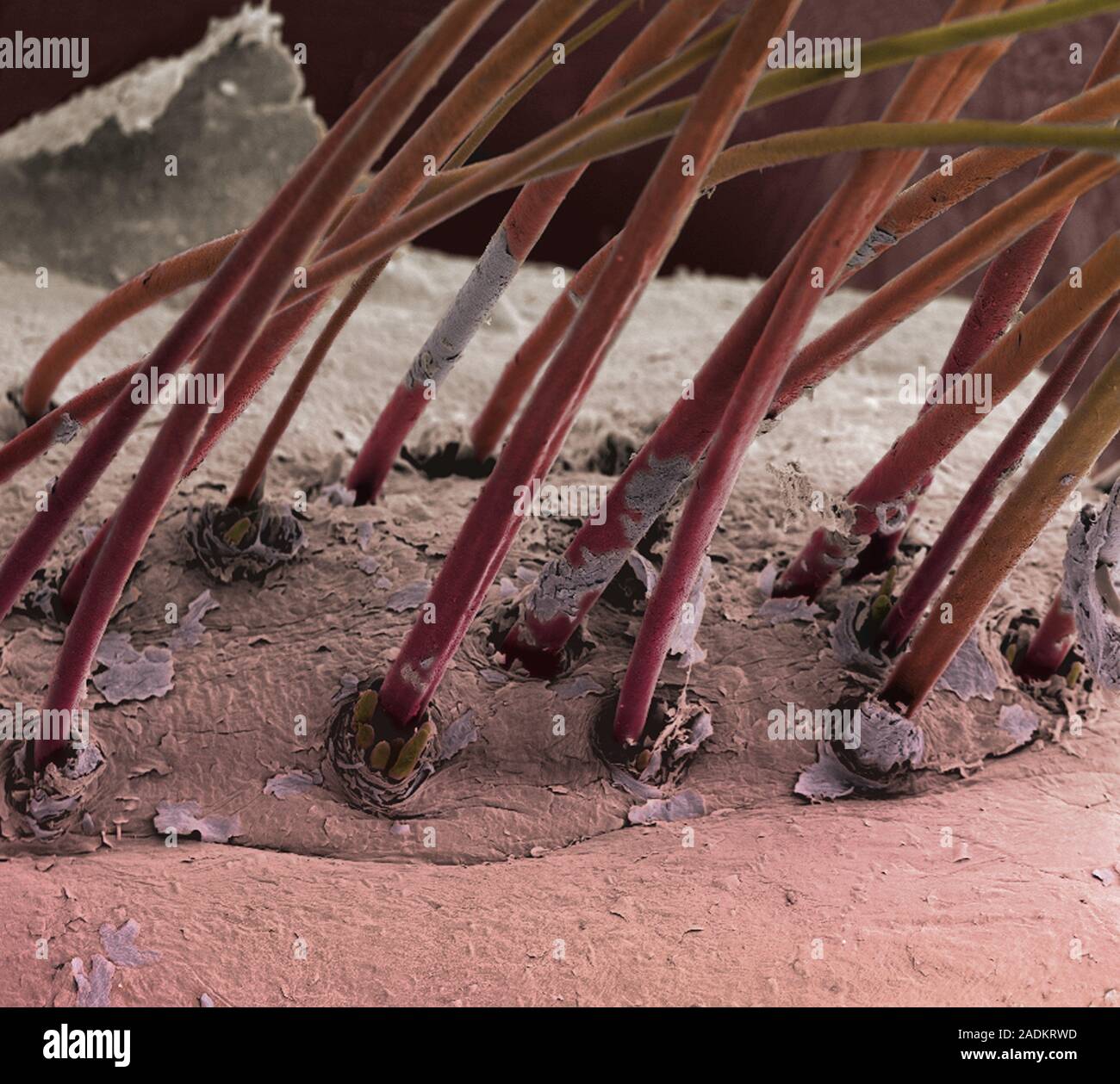 Eyelash hairs and skin. Coloured scanning electron micrograph (SEM) of ...