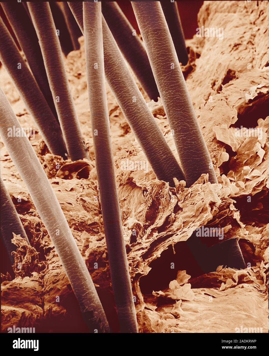 Human hair. Coloured scanning electron micrograph (SEM) of hair shafts ...