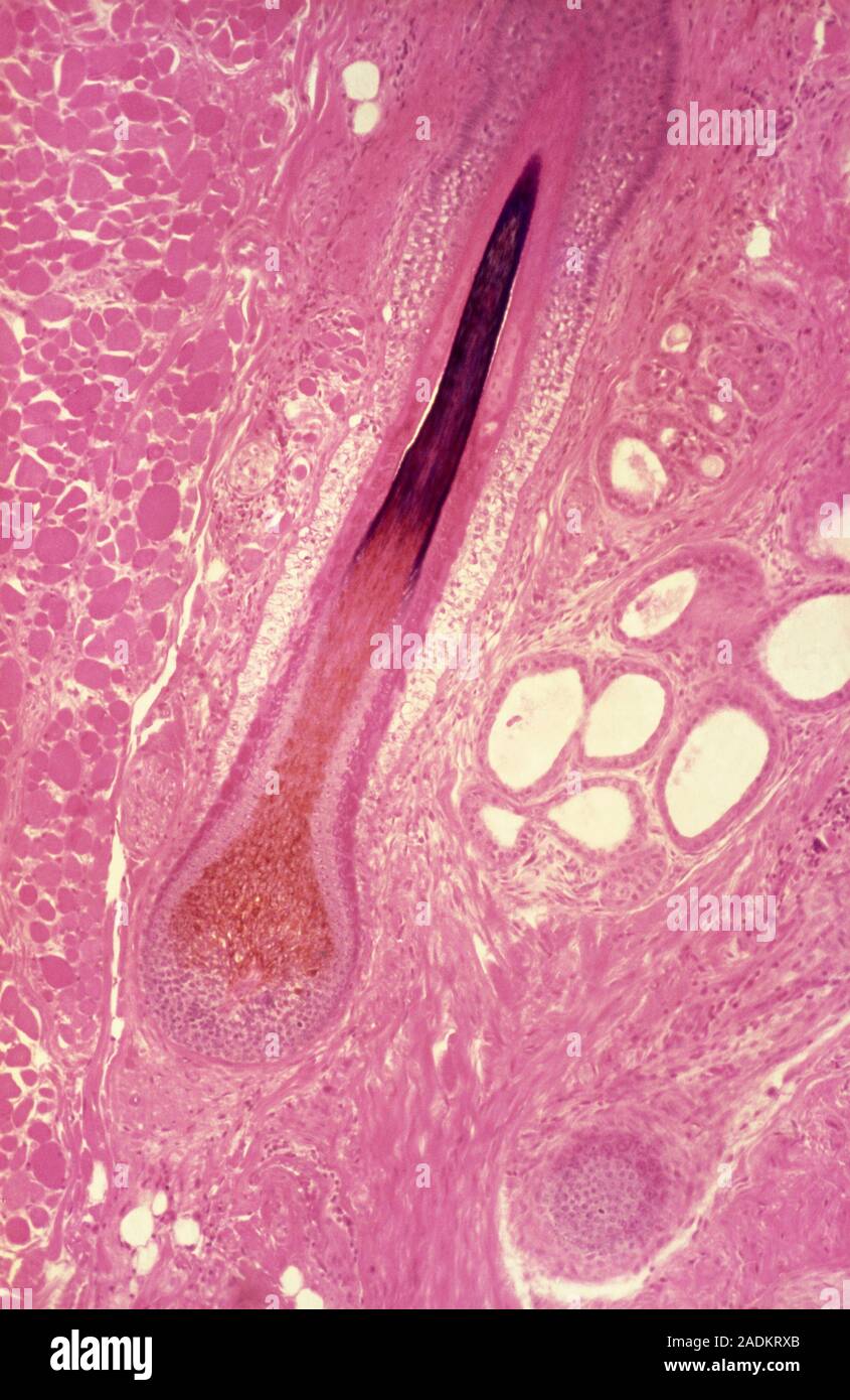 Unerupted hair, light micrograph. The hair is growing from its follicle ...