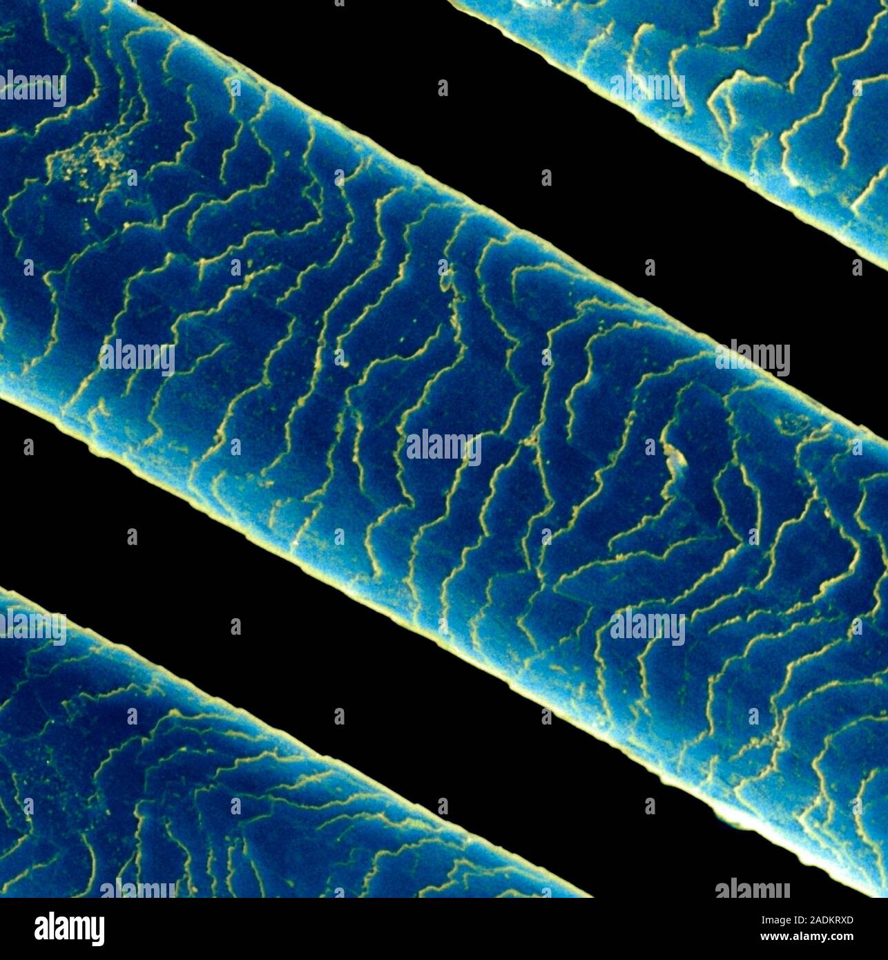Hairs. Coloured scanning electron micrograph (SEM) of a hair shaft. Two ...
