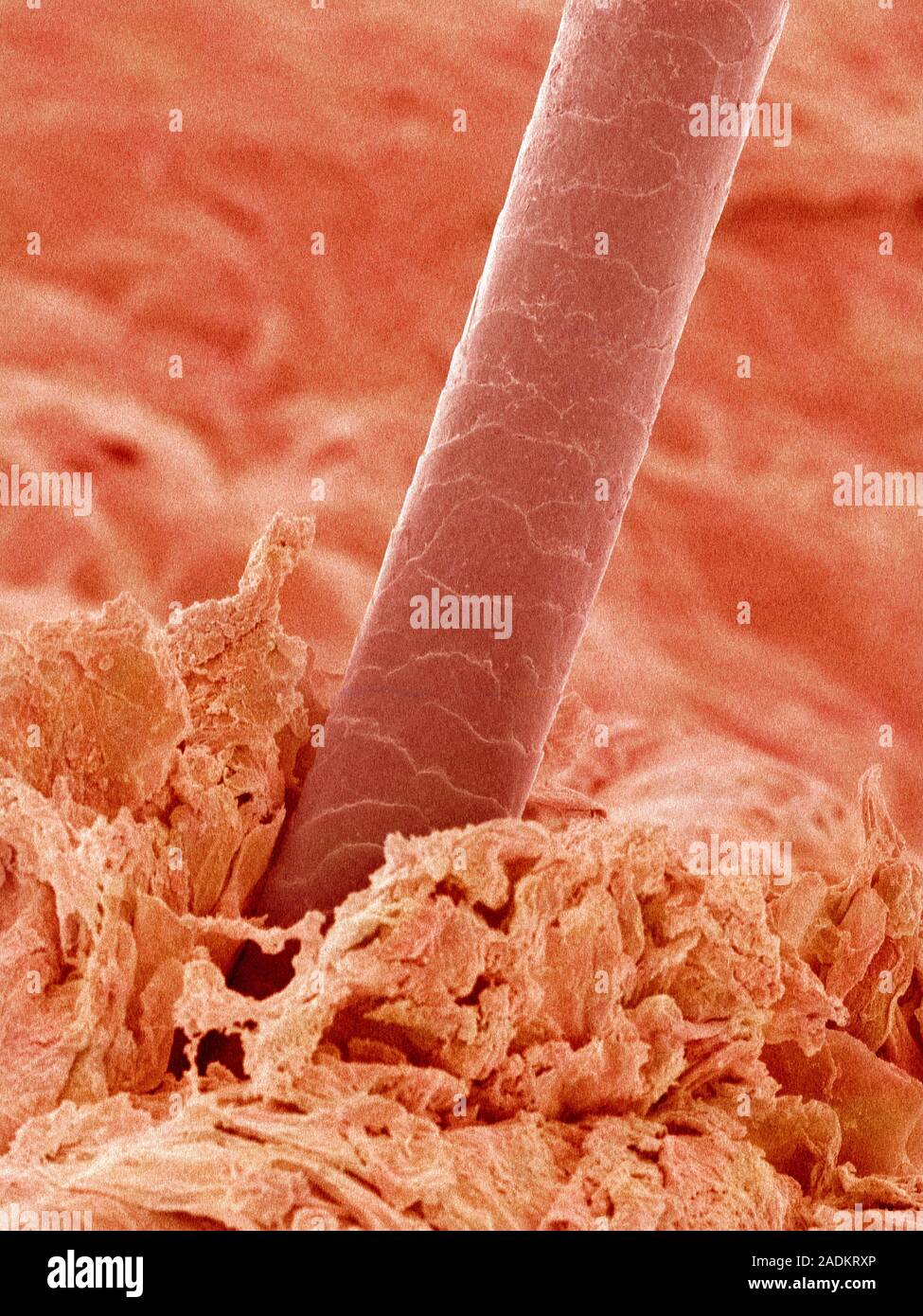 Human hair. Coloured scanning electron micrograph (SEM) of a human hair ...