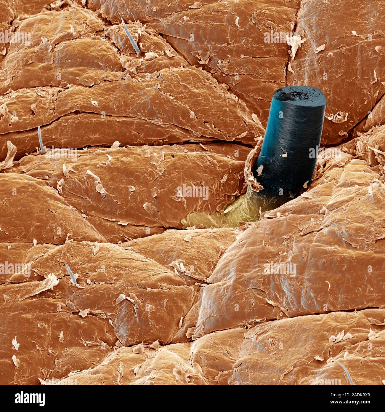 Hair stubble. Coloured scanning electron micrograph (SEM) of the cut ...